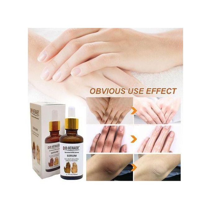 Shop Strong Dark Knuckles Removal Serum - 50ml